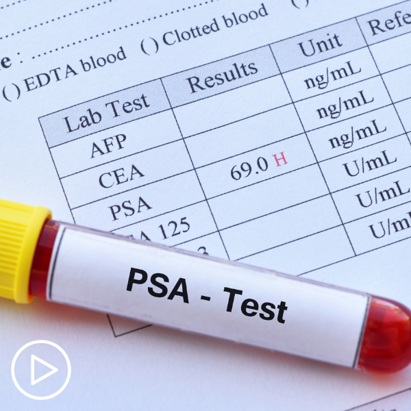 Understanding Recommended PSA Screening Age and Frequency In Prostate ...